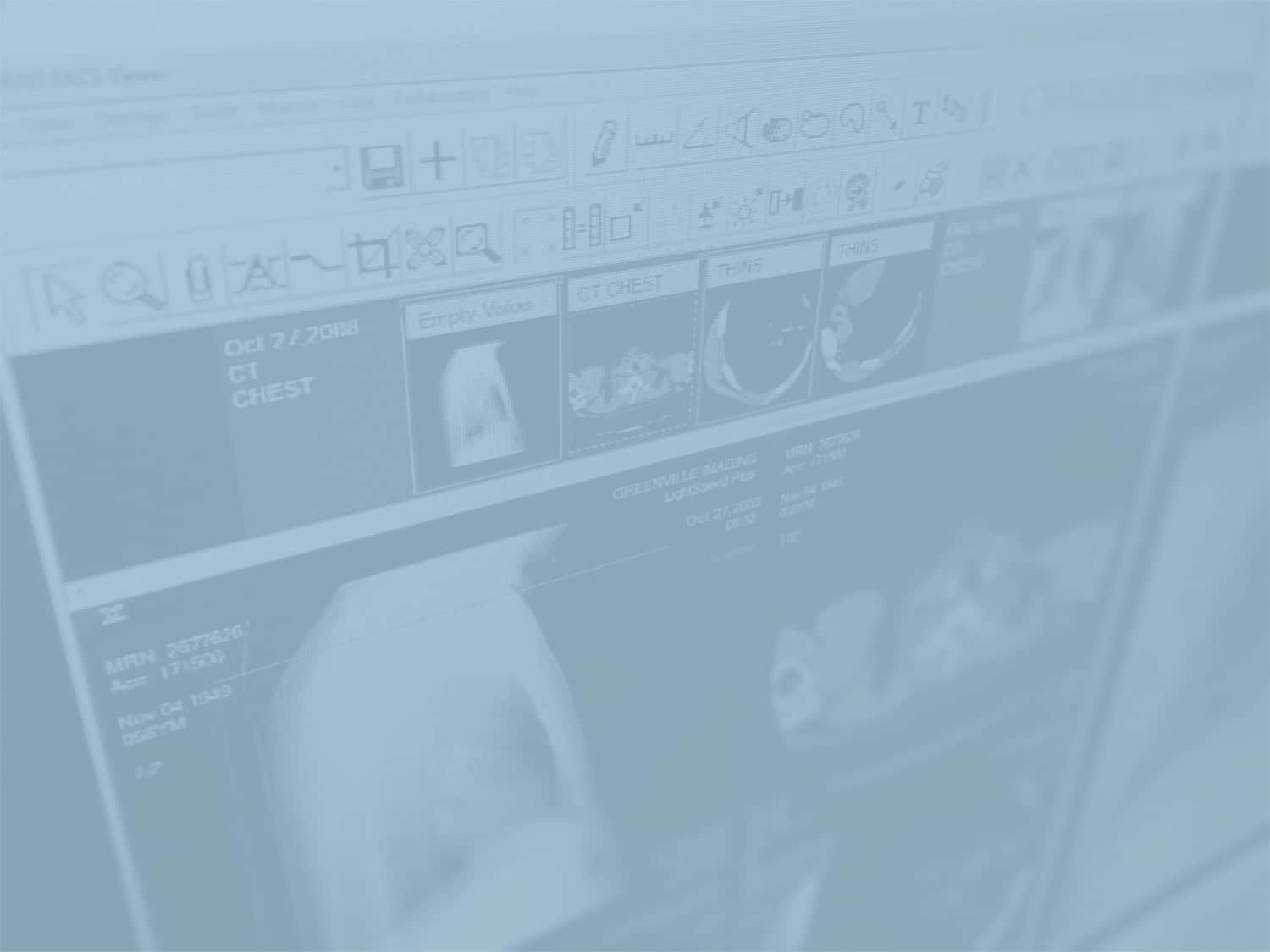 eRAD PACS Software | RIS Software - eRAD | PACS Radiology Information ...
